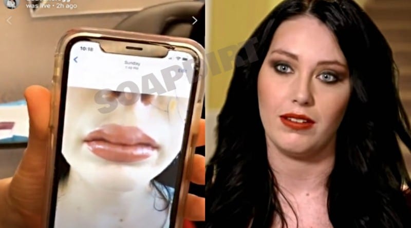 '90 Day Fiance': Deavan Clegg's Botched Procedure - Gruesome Pics of ...