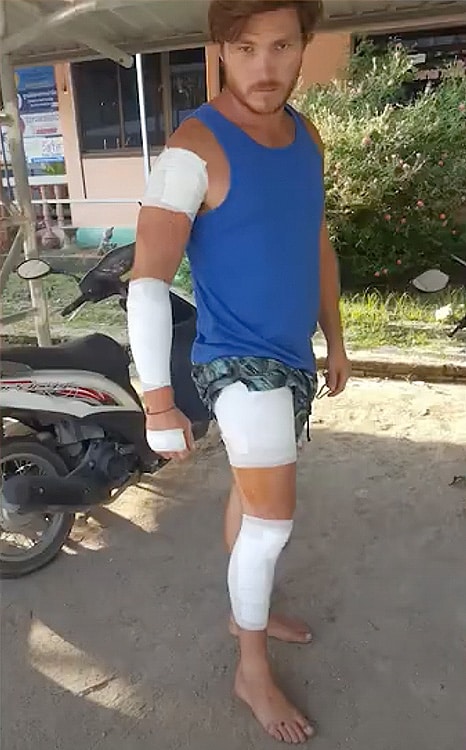 '90 Day Fiance': Syngin Colchester’s Gruesome Motorcycle Accident ...