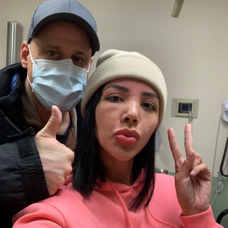 90 Day Fiance Jasmine Pinedas Shocking Allergic Reaction Photos